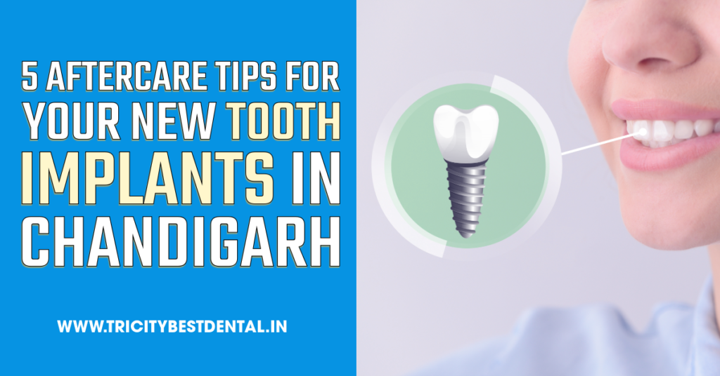 5 Aftercare Tips for Your New Tooth Implants in Chandigarh